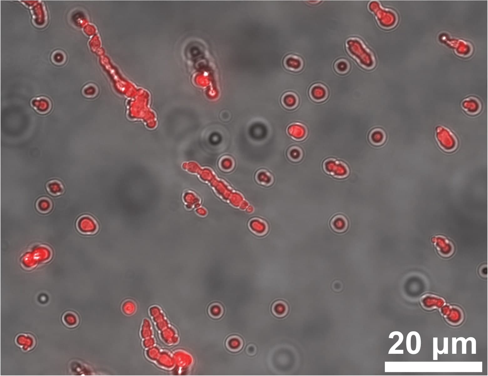 BBML — Liquid-Liquid Phase Separation